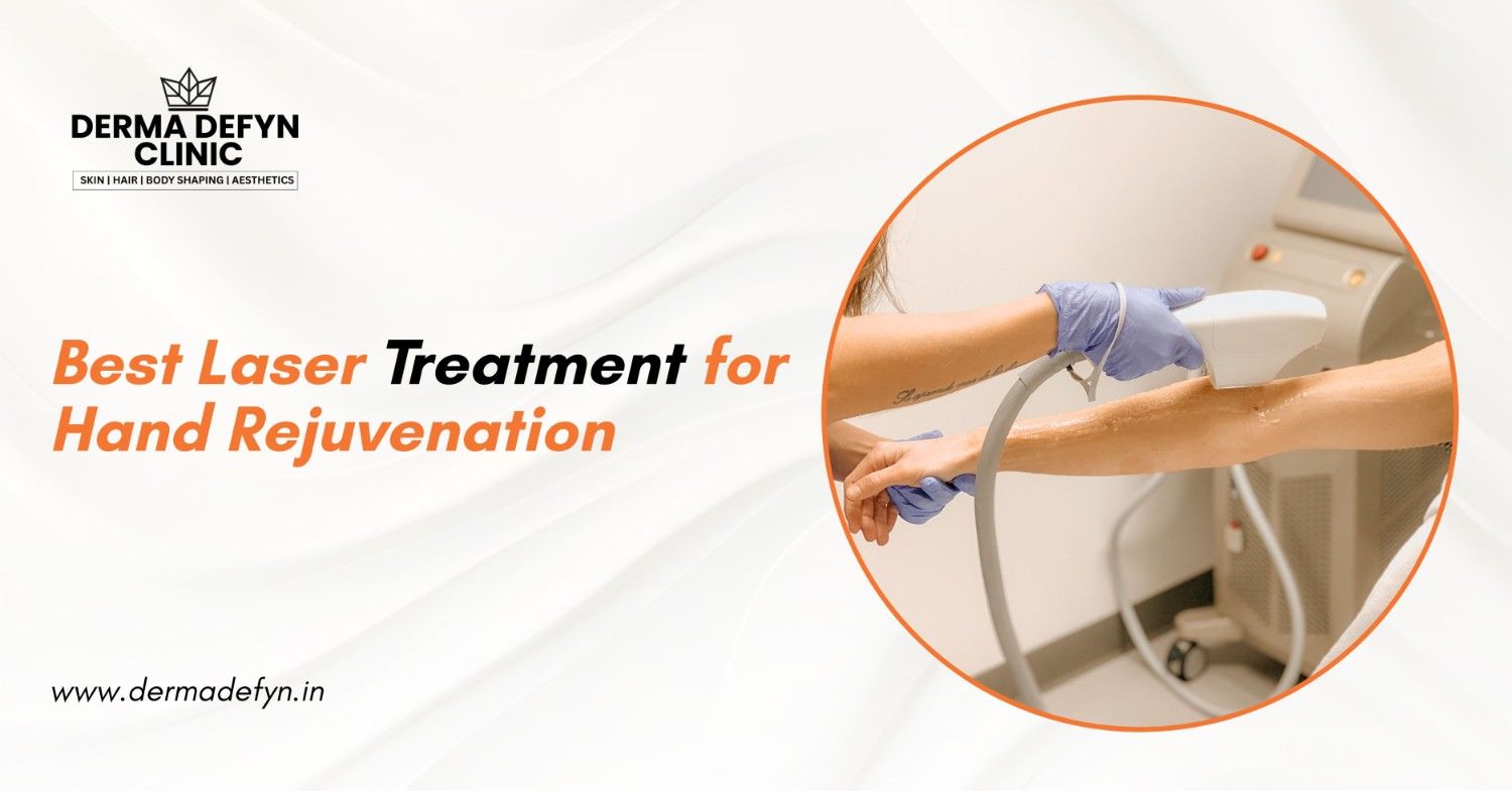 Best Laser Treatment for Hand Rejuvenation in Delhi